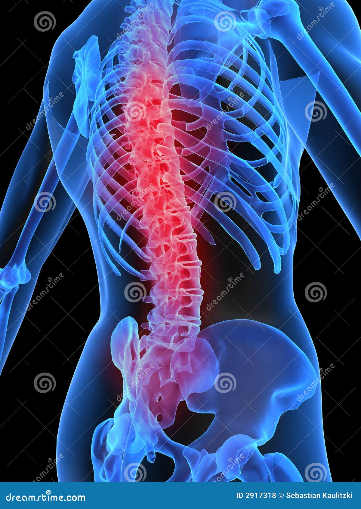 Backache stock illustration. Illustration of skull, health - 2917318