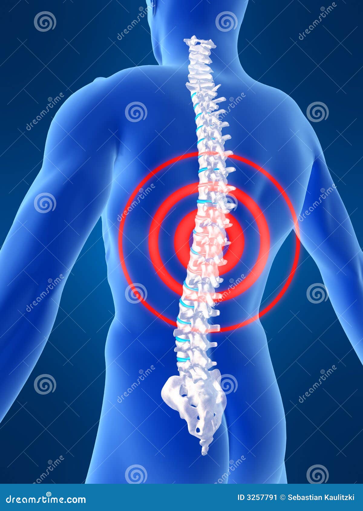 Backache stock illustration. Illustration of ilium, science - 3257791
