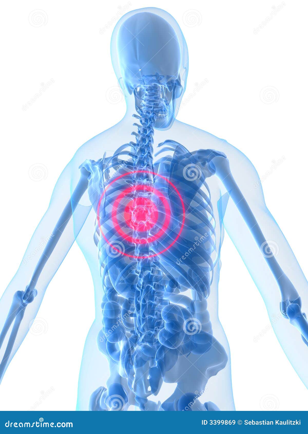 Backache stock illustration. Illustration of human, arthritis - 3399869