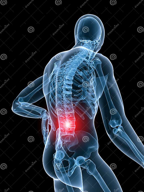 Backache stock illustration. Illustration of anatomical - 4000614