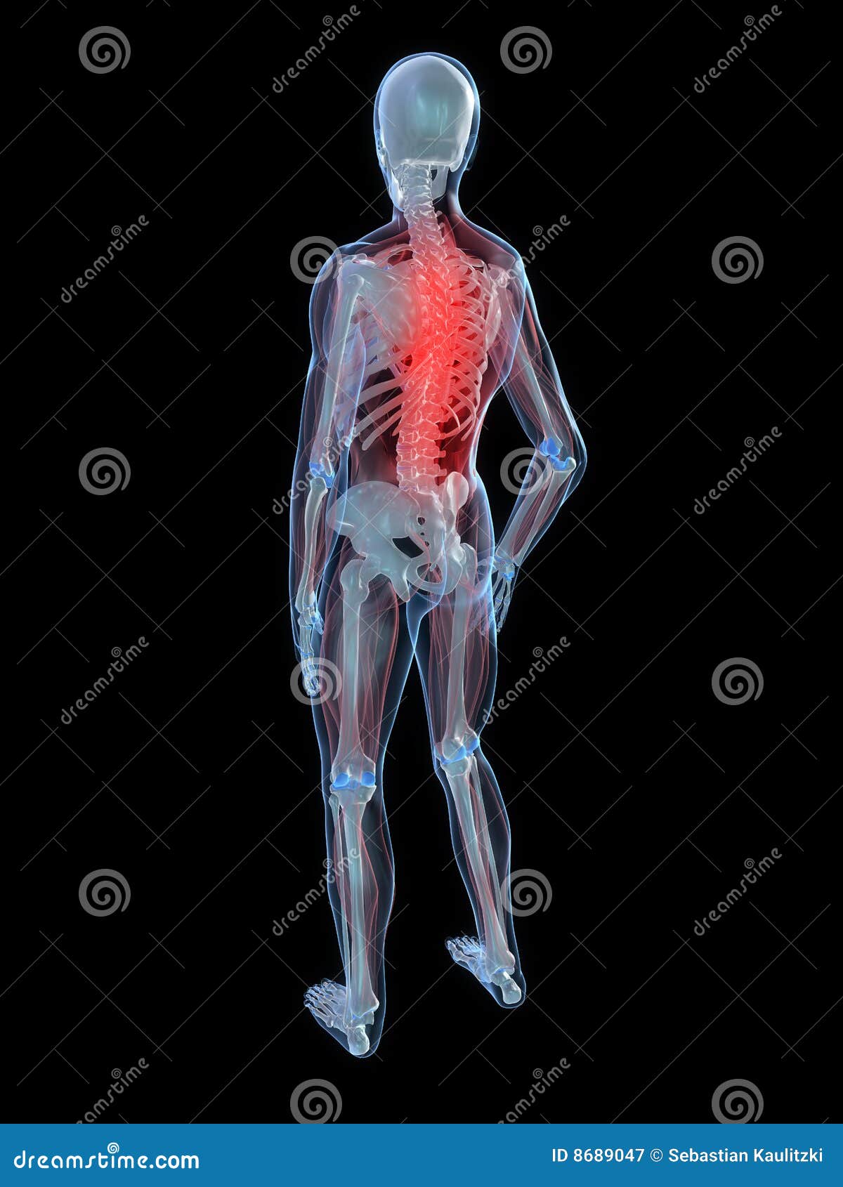 Backache stock illustration. Illustration of anatomical - 8689047