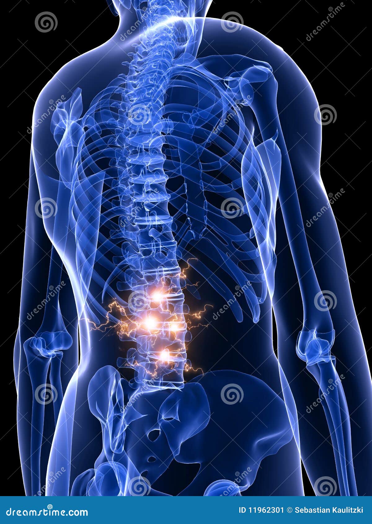 Backache illustration stock illustration. Illustration of chest - 11962301