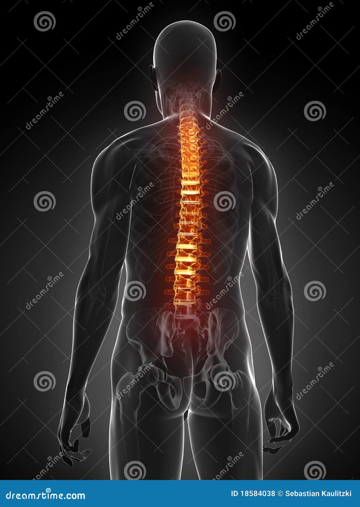 Backache illustration stock illustration. Illustration of ache - 18584038