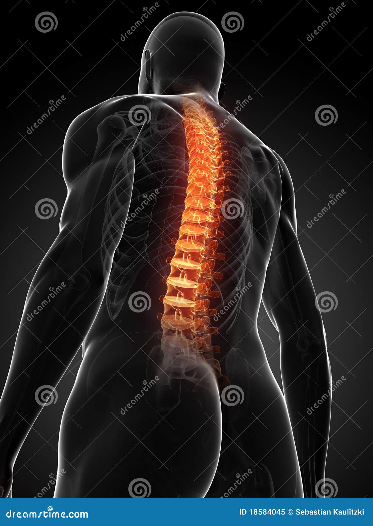 Backache illustration stock illustration. Illustration of inflammation ...