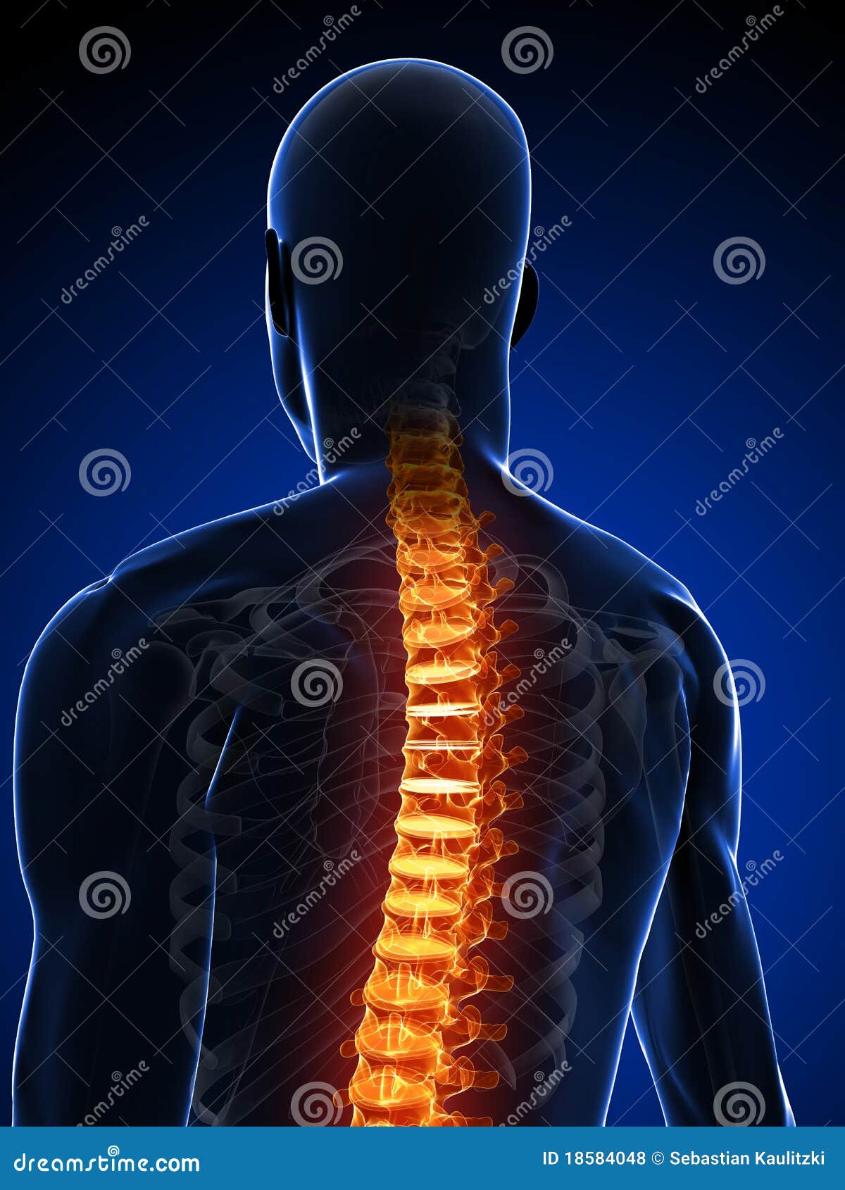 Backache illustration stock illustration. Illustration of human - 18584048