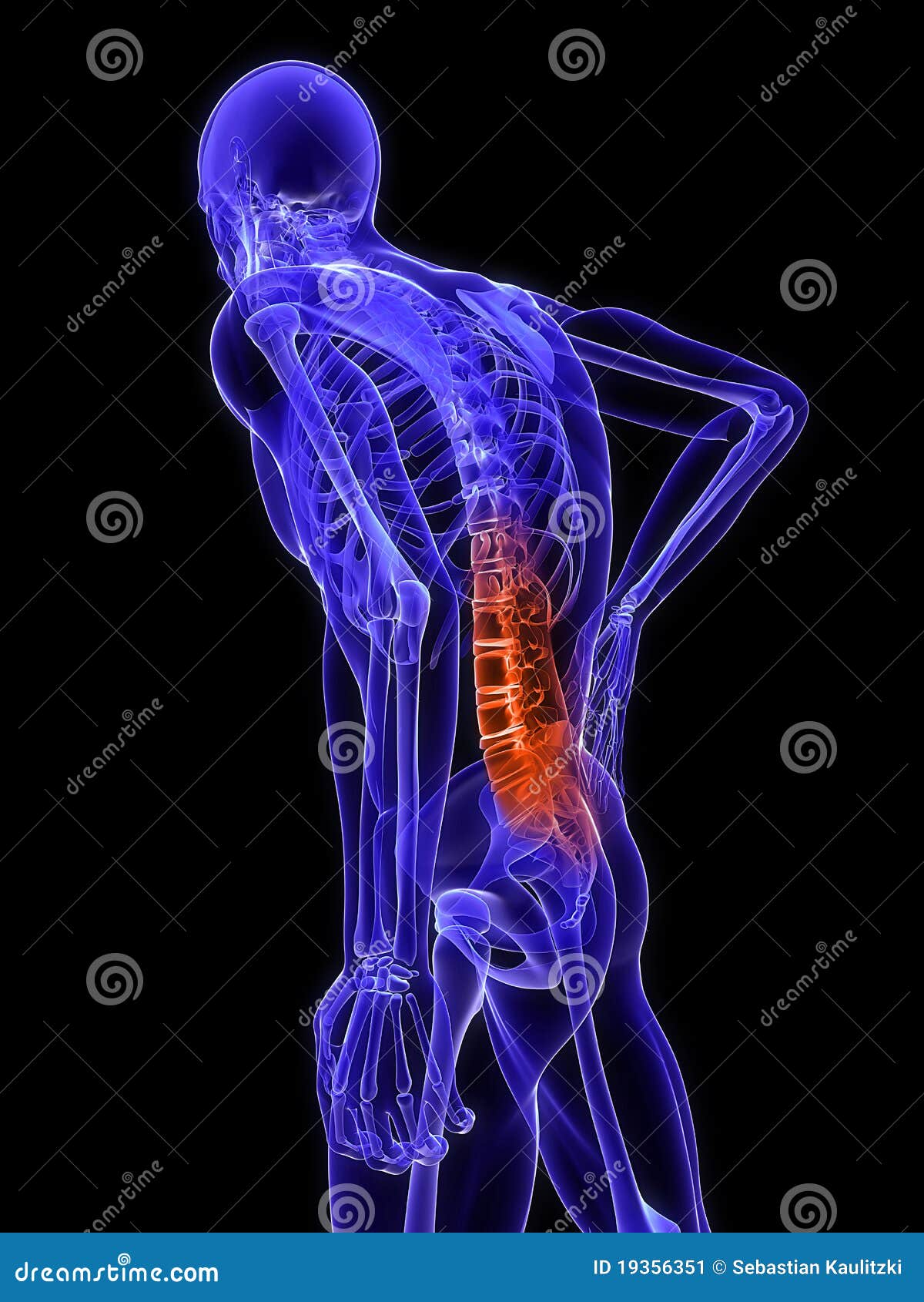 Backache illustration stock illustration. Illustration of body - 19356351