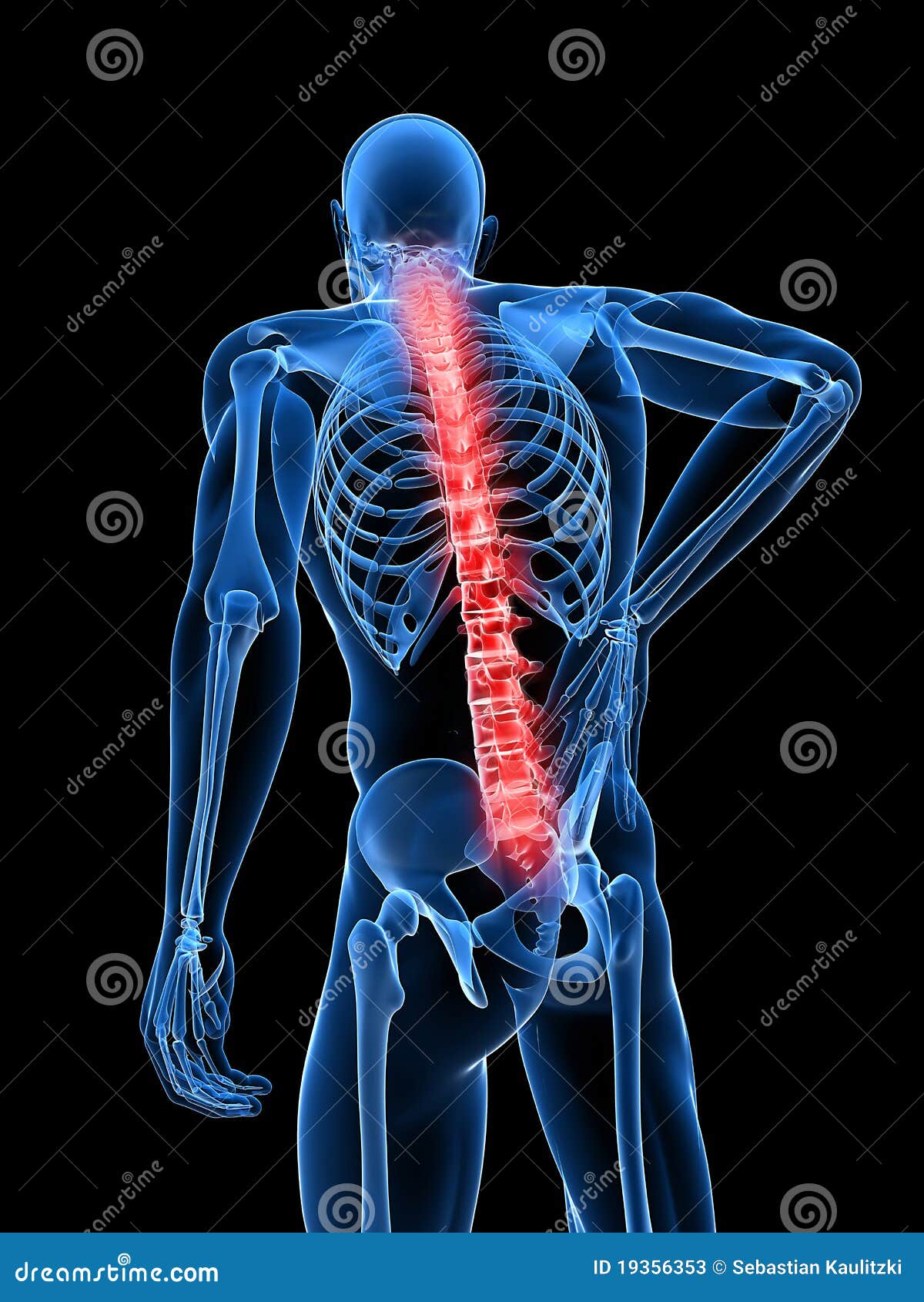 Backache illustration stock illustration. Illustration of study - 19356353