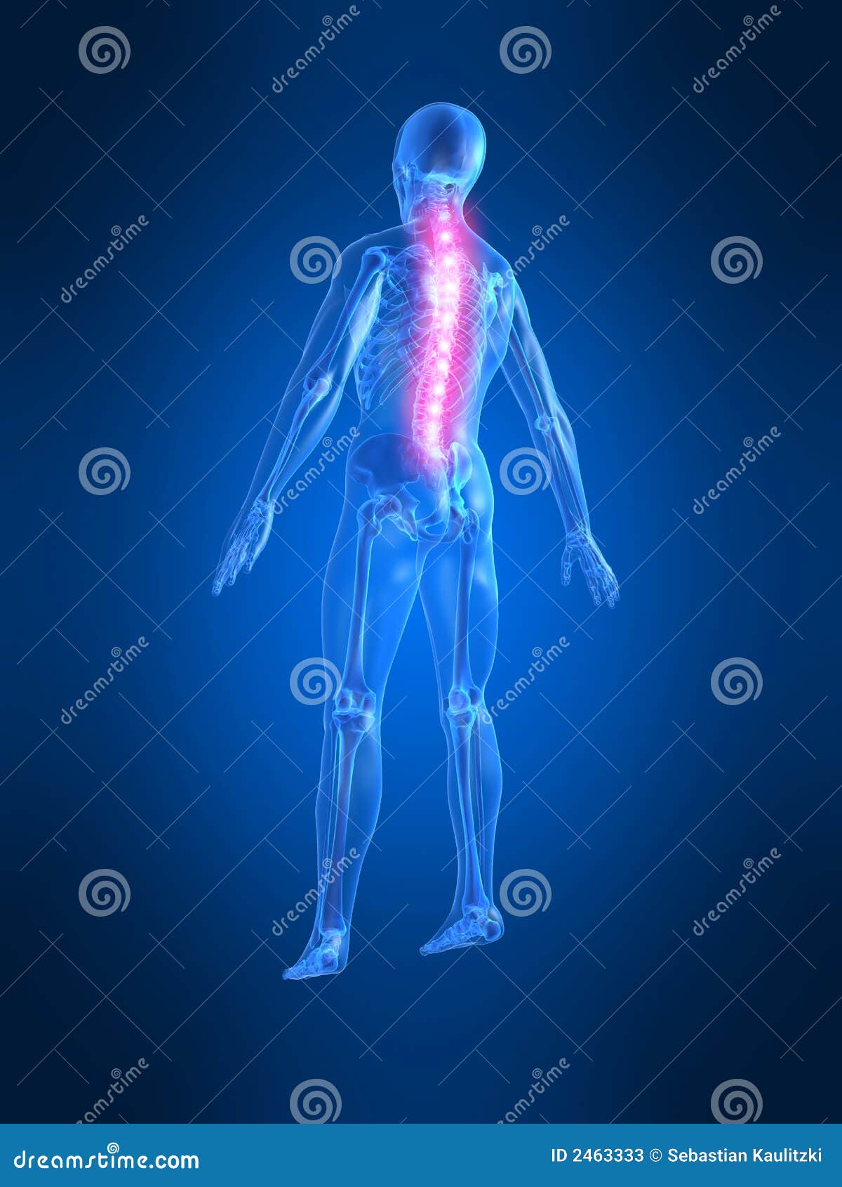 Backache illustration stock illustration. Illustration of spine - 2463333