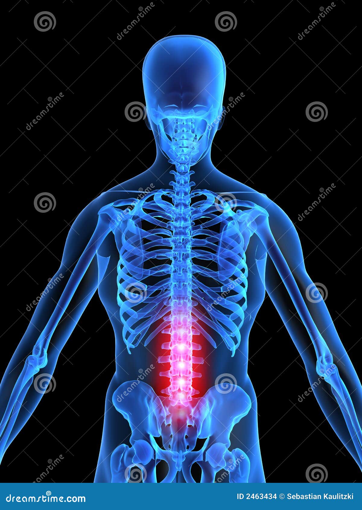 Backache Illustration Royalty-Free Cartoon | CartoonDealer.com #19356353