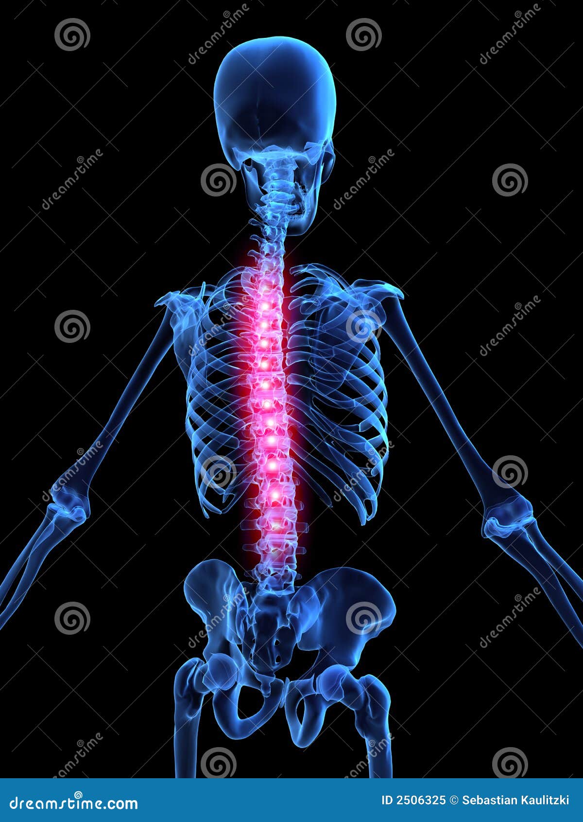 Backache illustration stock illustration. Illustration of torso - 2506325