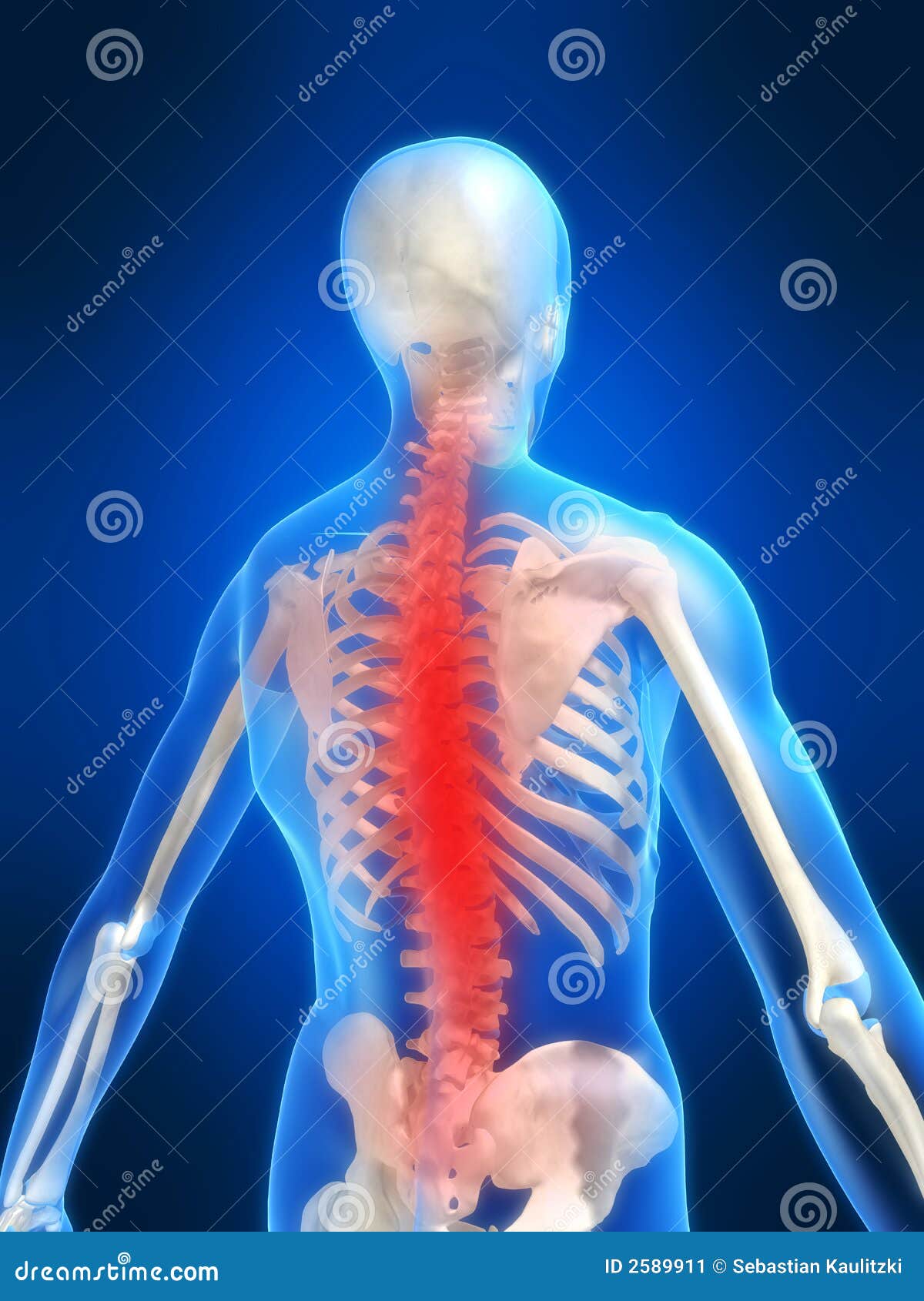 Backache illustration stock illustration. Illustration of biology - 2589911