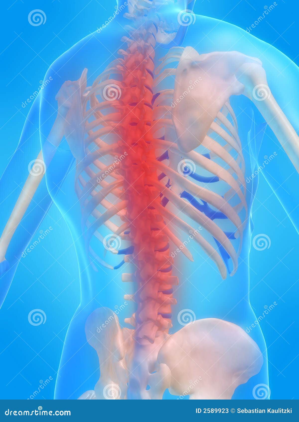 Backache illustration stock illustration. Illustration of biological ...