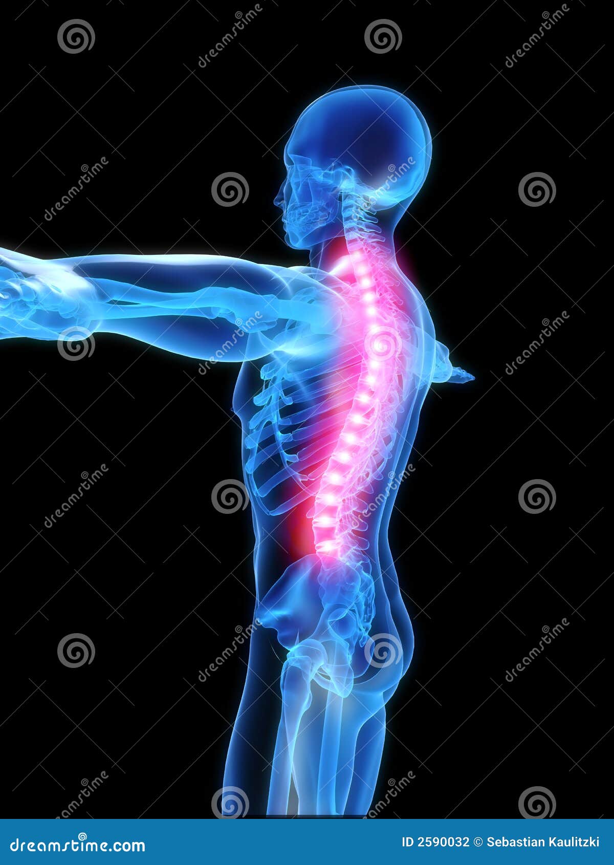 Backache illustration stock illustration. Illustration of biology - 2590032