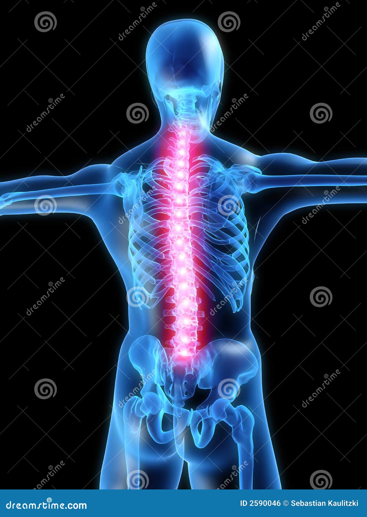 Backache illustration stock illustration. Illustration of arthralgia ...