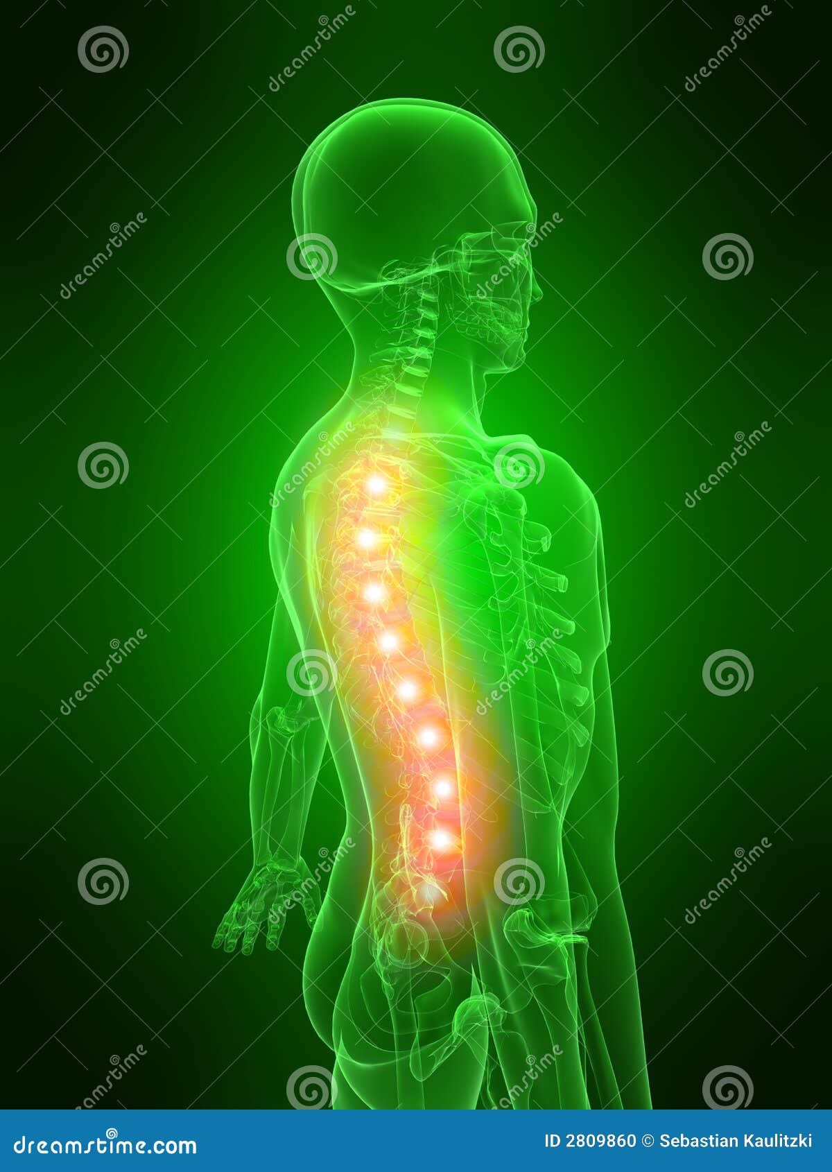 Backache illustration stock illustration. Illustration of body - 2809860