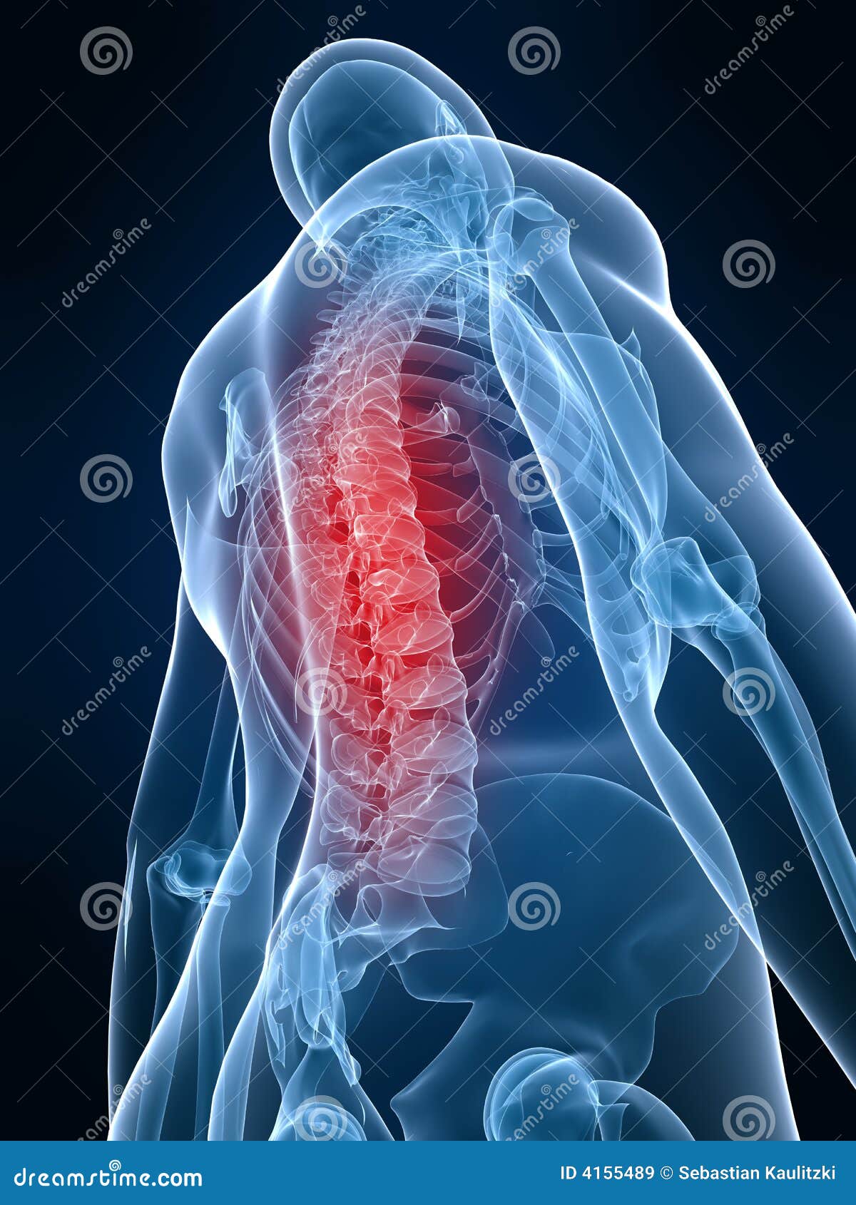 Backache illustration stock illustration. Illustration of anatomy - 4155489