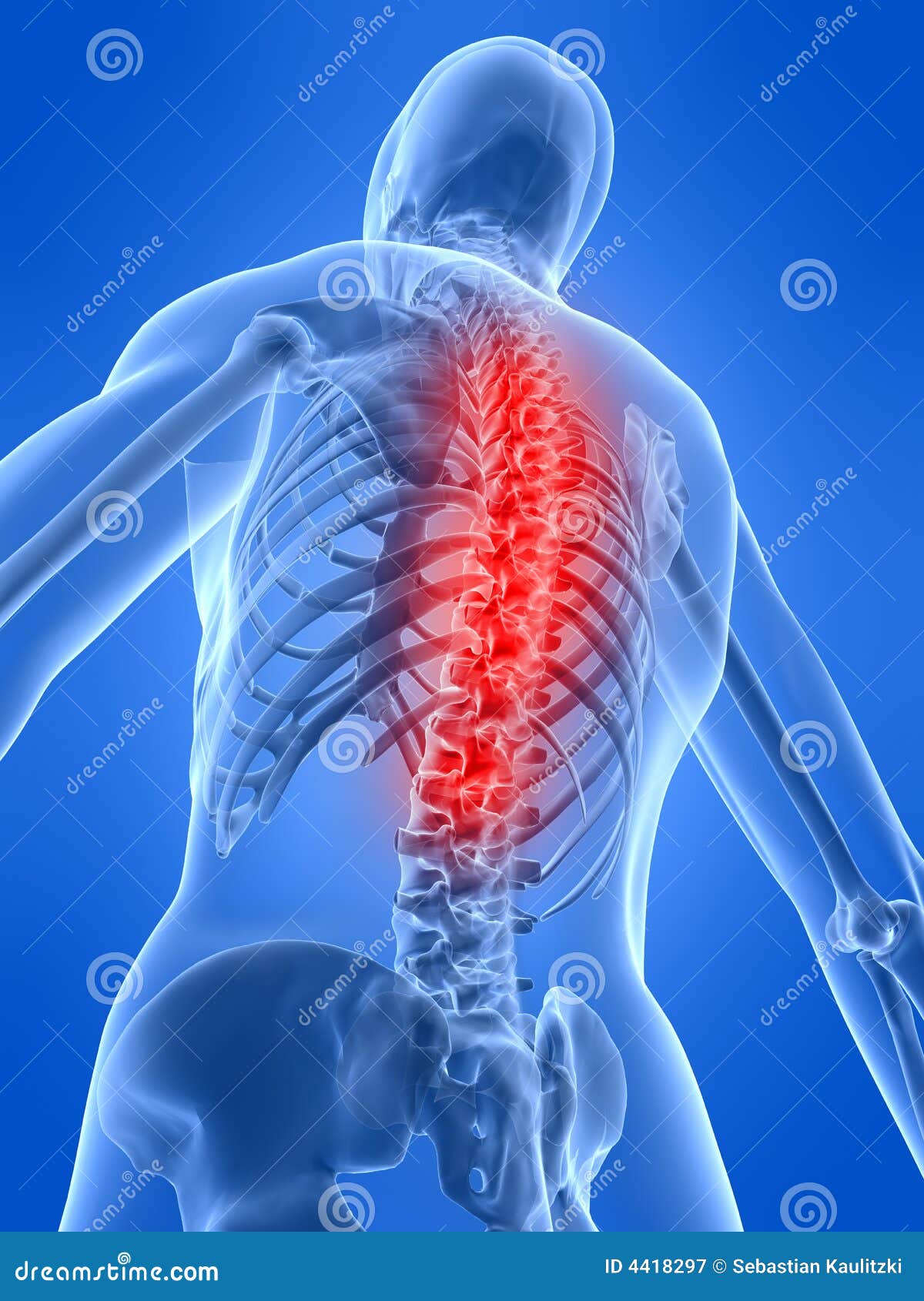 Backache illustration stock illustration. Illustration of chest - 4418297