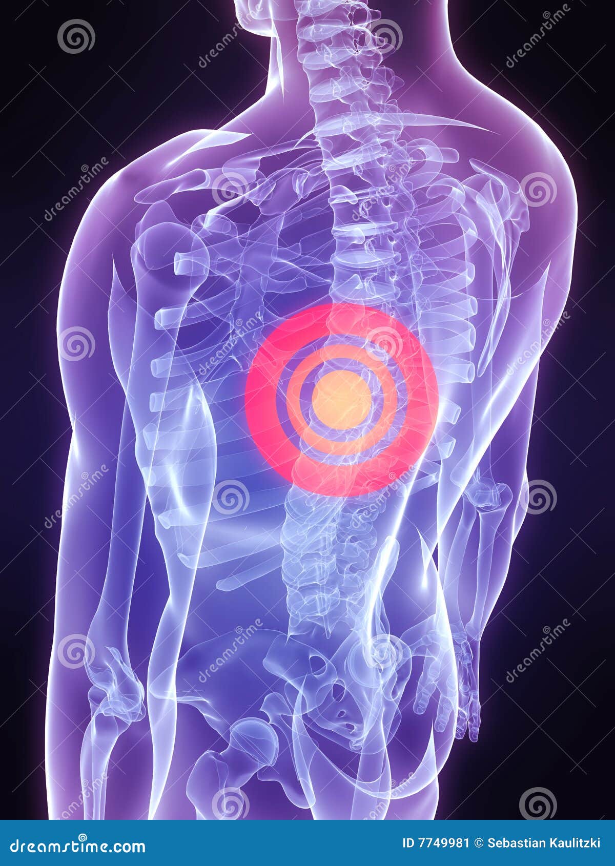 Backache illustration stock illustration. Illustration of medical - 7749981