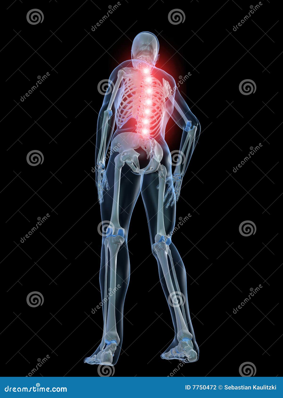 Backache illustration stock illustration. Illustration of pain - 7750472