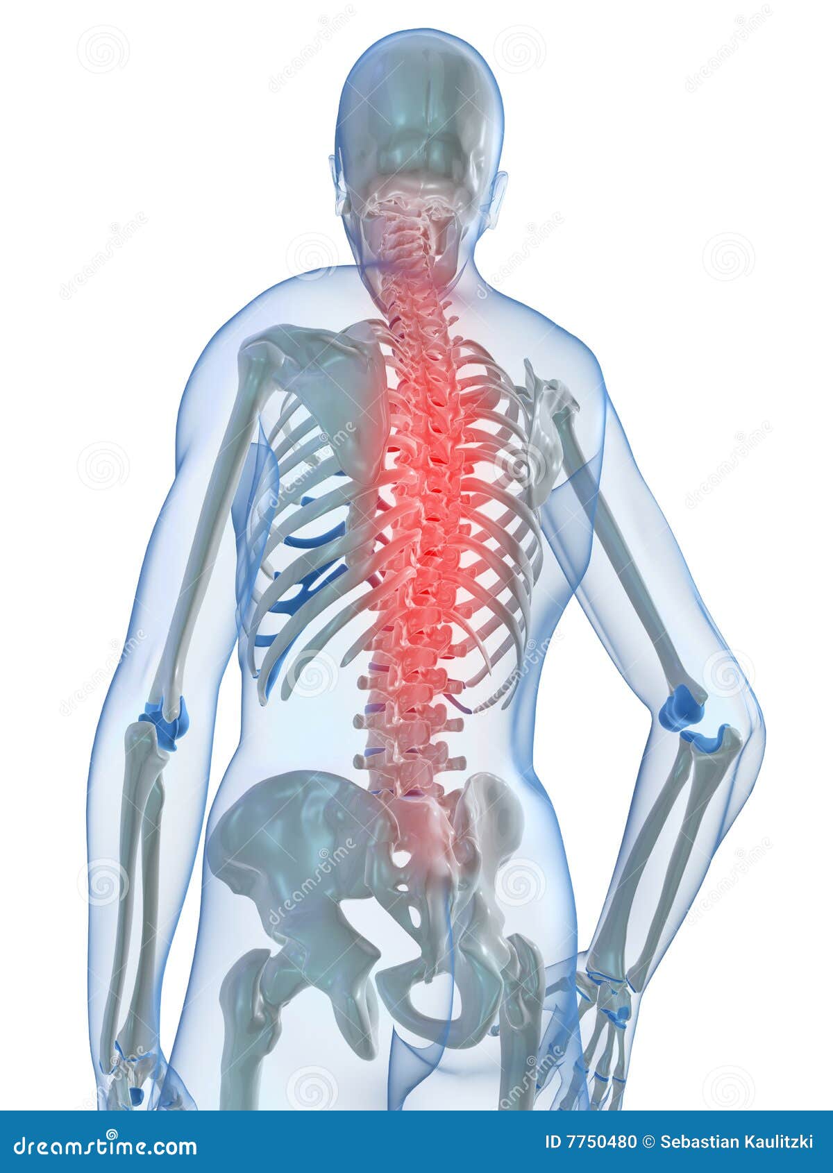 Backache illustration stock illustration. Illustration of human - 7750480