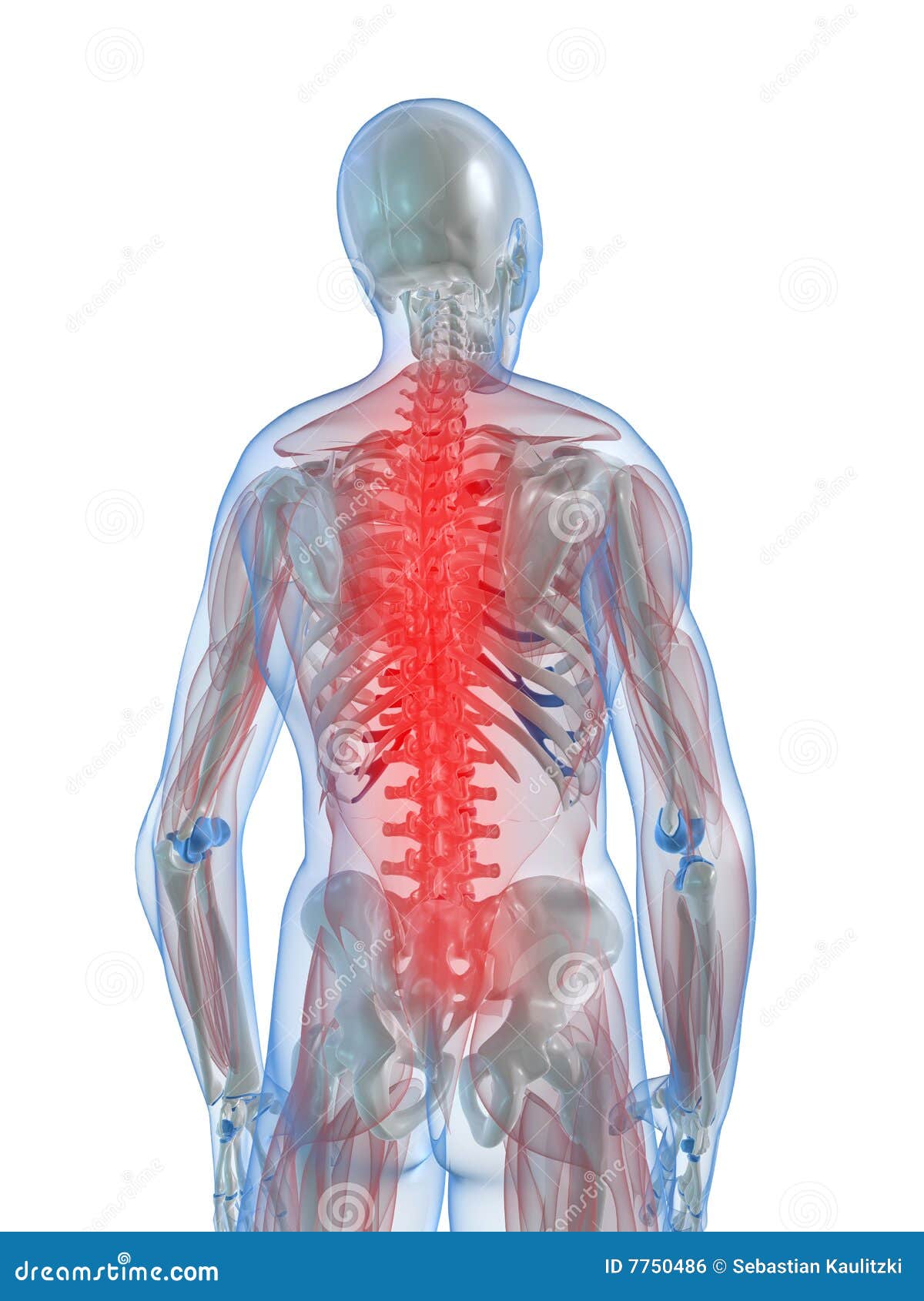 Backache illustration stock illustration. Illustration of anatomy - 7750486
