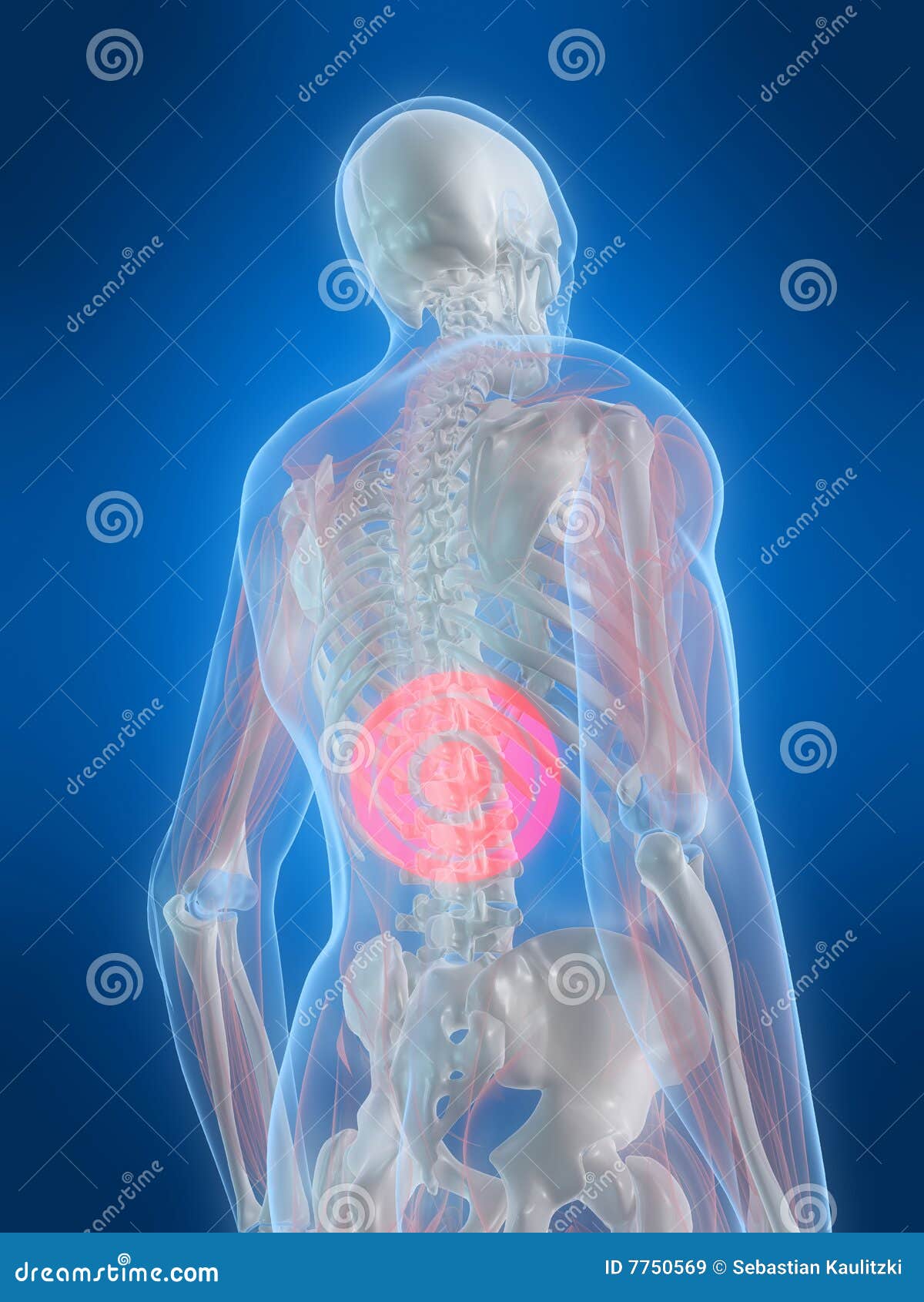 Backache illustration stock illustration. Illustration of bones - 7750569