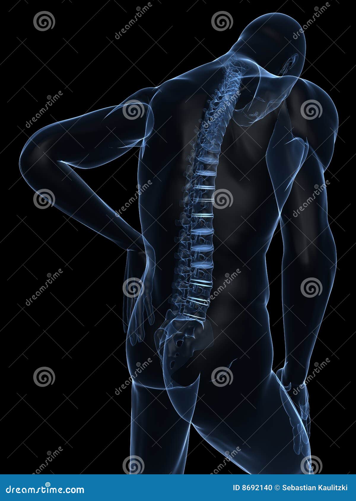 Backache illustration stock illustration. Illustration of arthritis ...