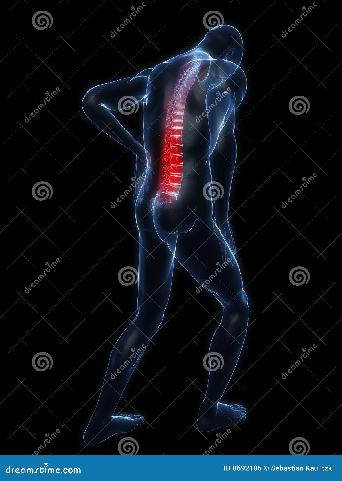 Backache illustration stock illustration. Illustration of medical - 8692186