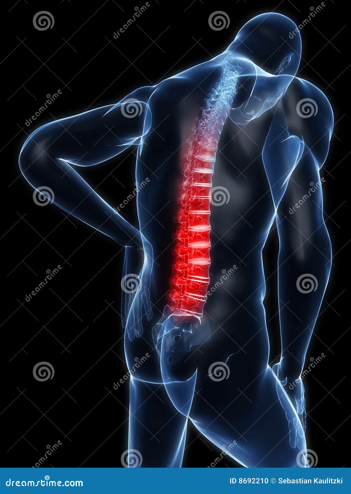 Backache illustration stock illustration. Illustration of rheumatism ...