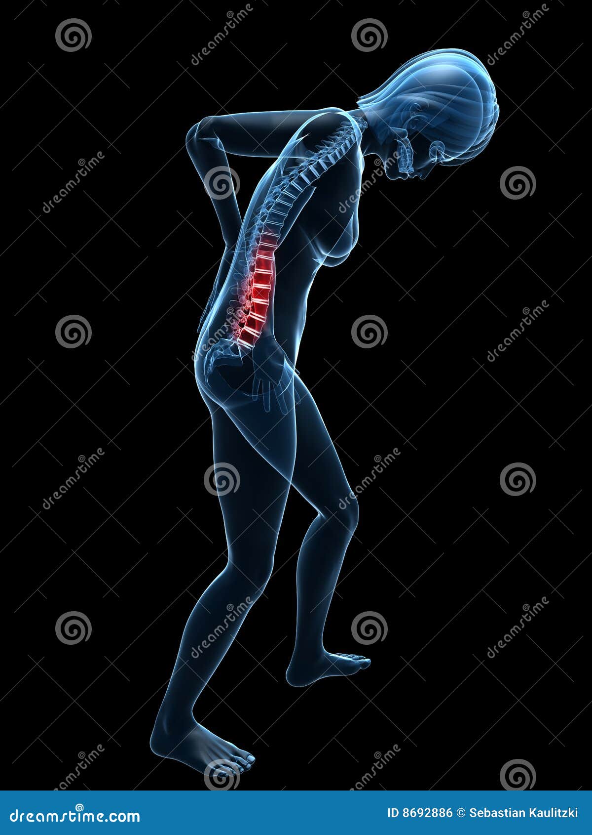 Backache illustration stock illustration. Illustration of medical - 8692886