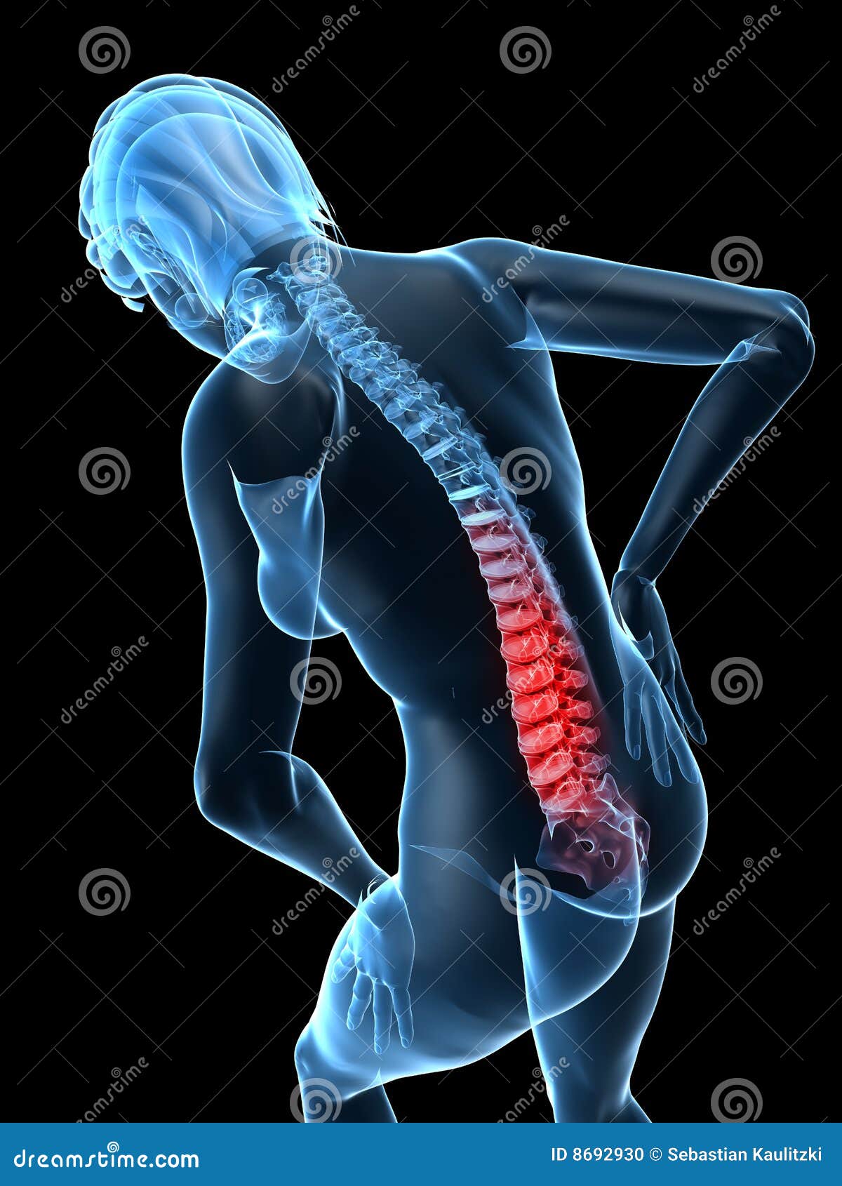 Backache illustration stock illustration. Illustration of skeletal ...