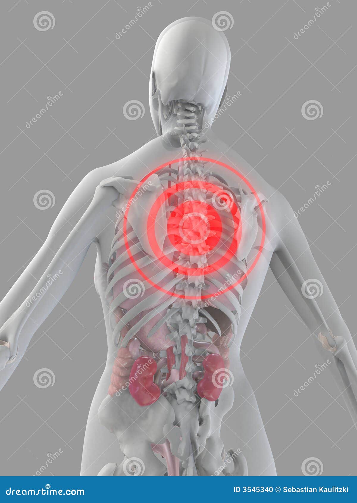 Backache inflammation stock illustration. Illustration of spine - 3545340