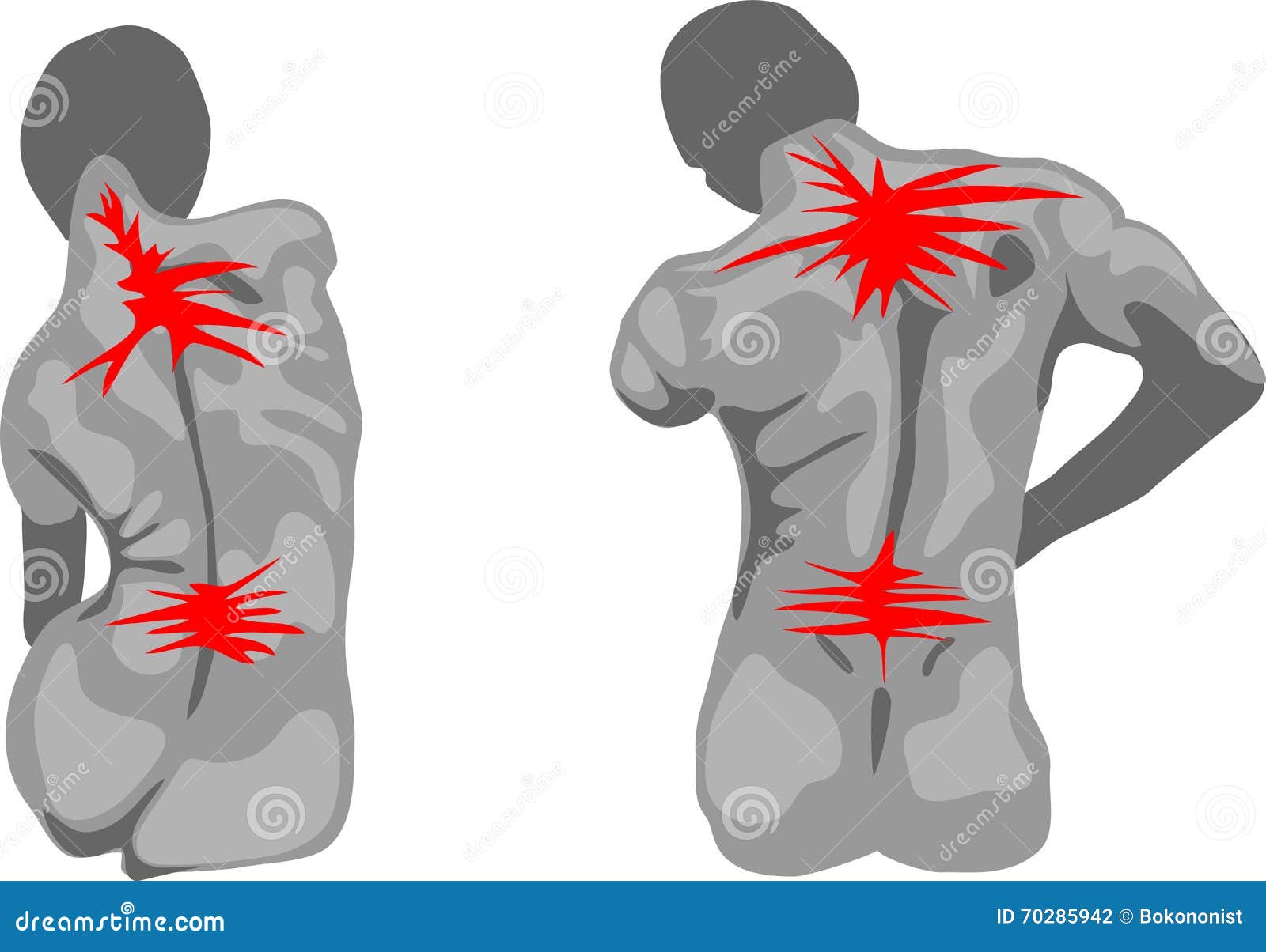 Backache stock vector. Illustration of rest, exercise - 70285942