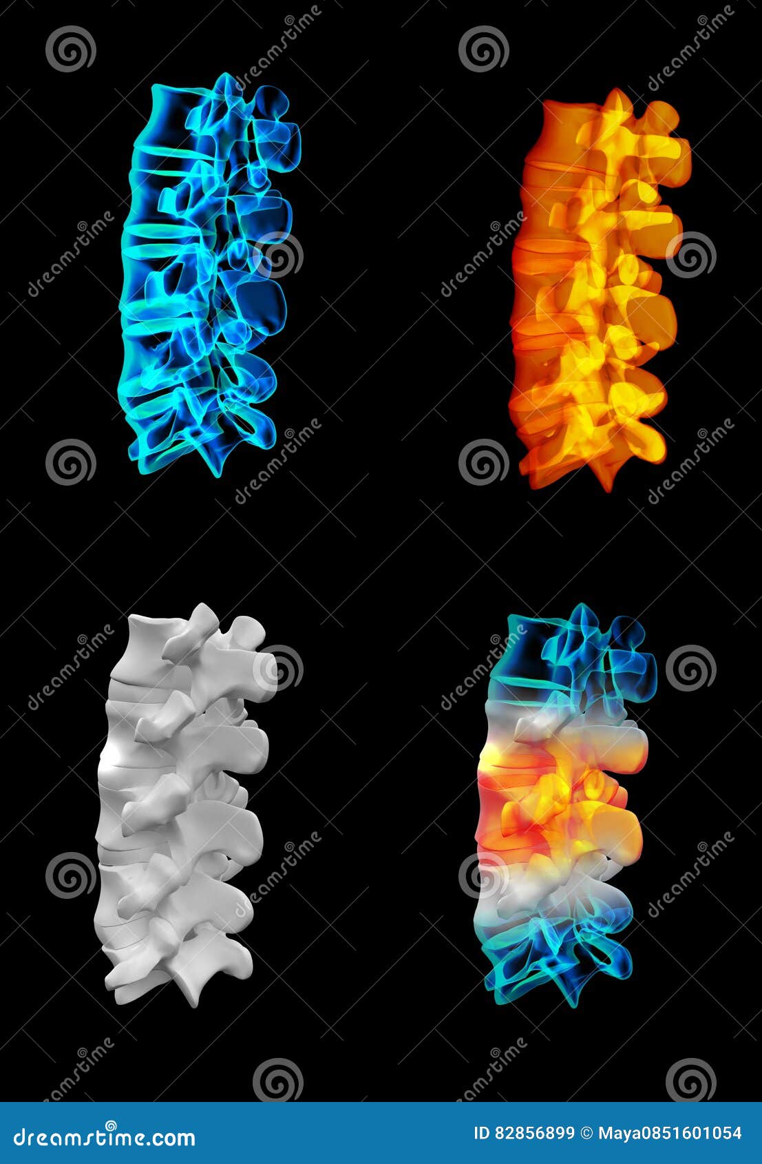 Backbone stock illustration. Illustration of bone, back - 82856899