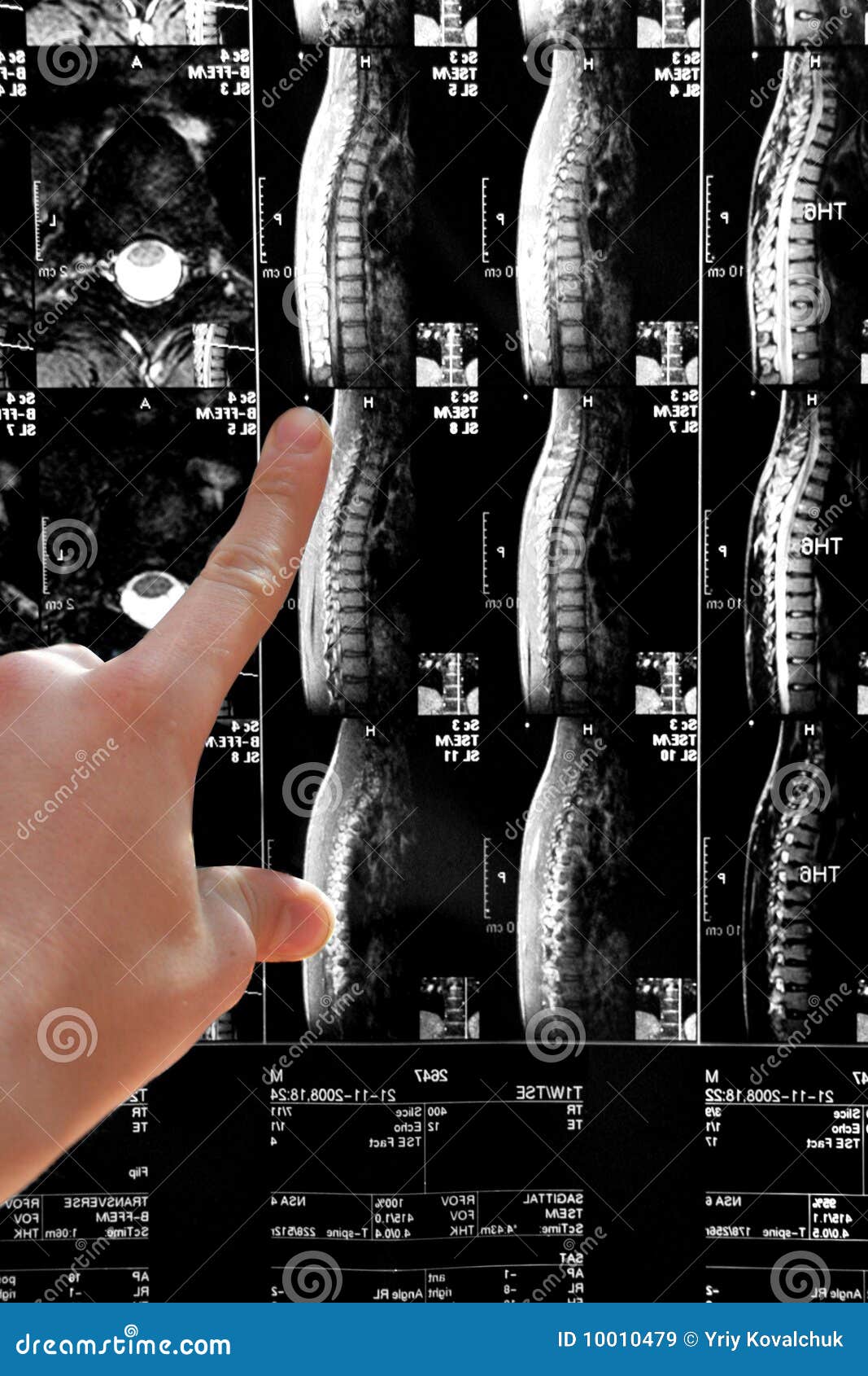 Backbone X-ray stock image. Image of physiology, medical - 10010479
