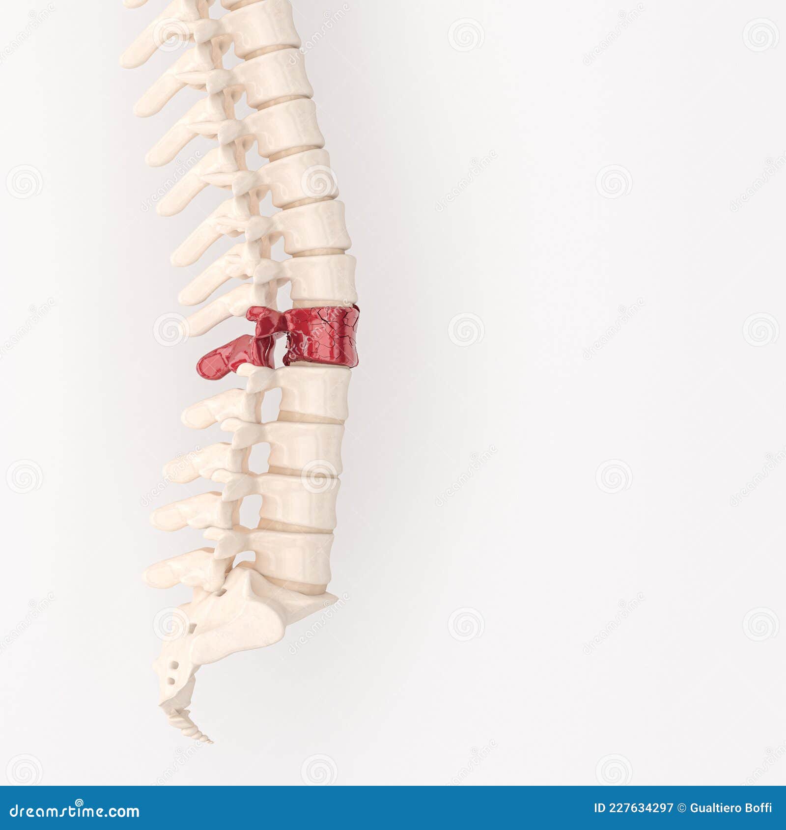 Backbone with Red Fragmented Vertebrae Stock Illustration ...