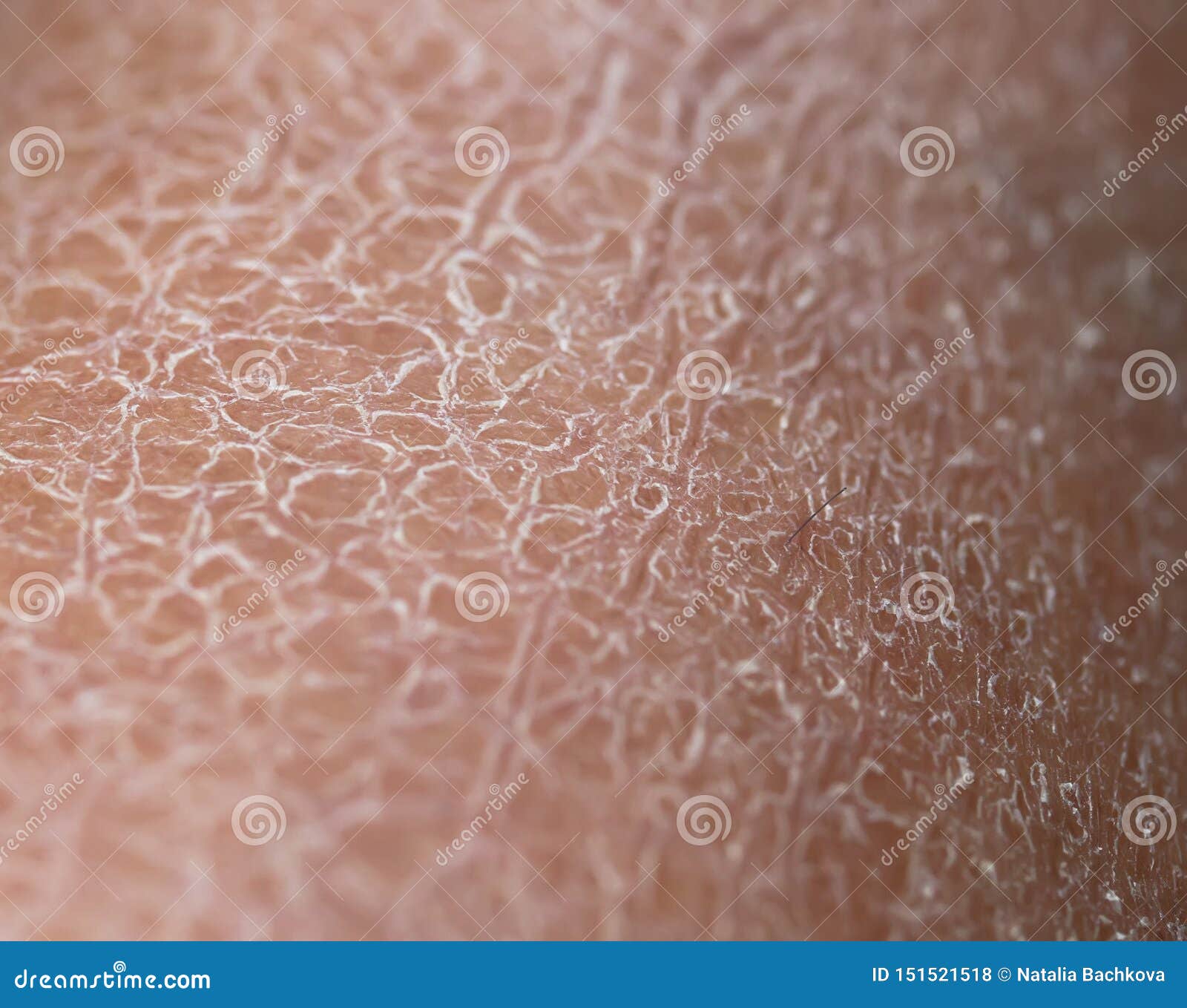 Background of the Texture of the Skin is Covered with Small and Large ...