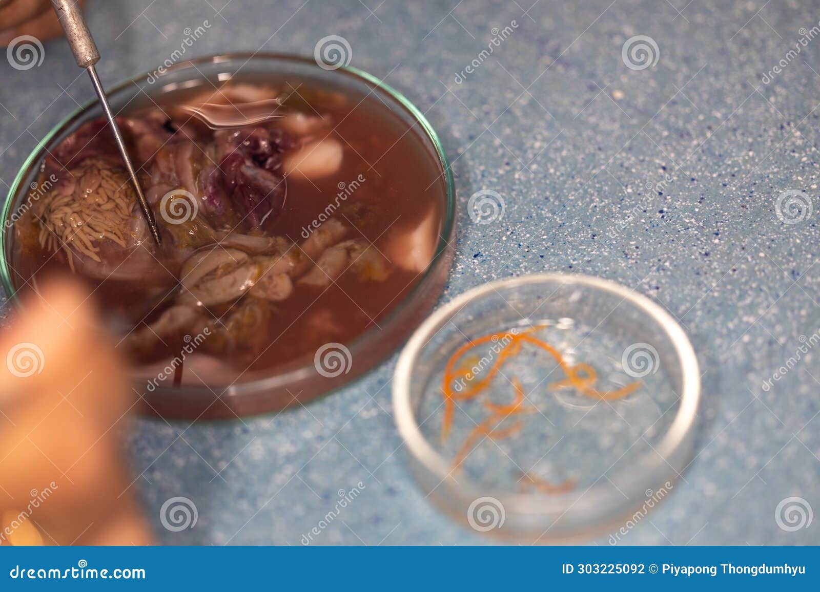 Acanthocephalans (Thorny-headed Worms, or Spiny-headed Worms) Under the ...
