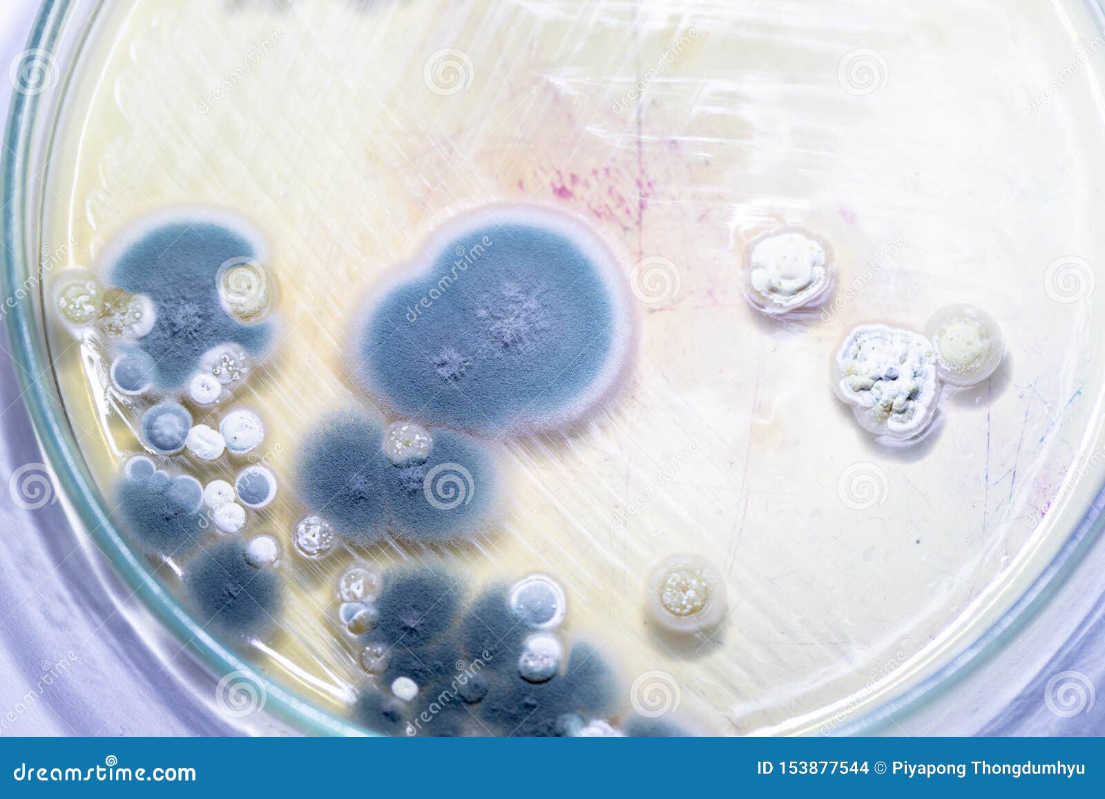 Backgrounds of Characteristics and Different Shaped Colony of Bacteria ...