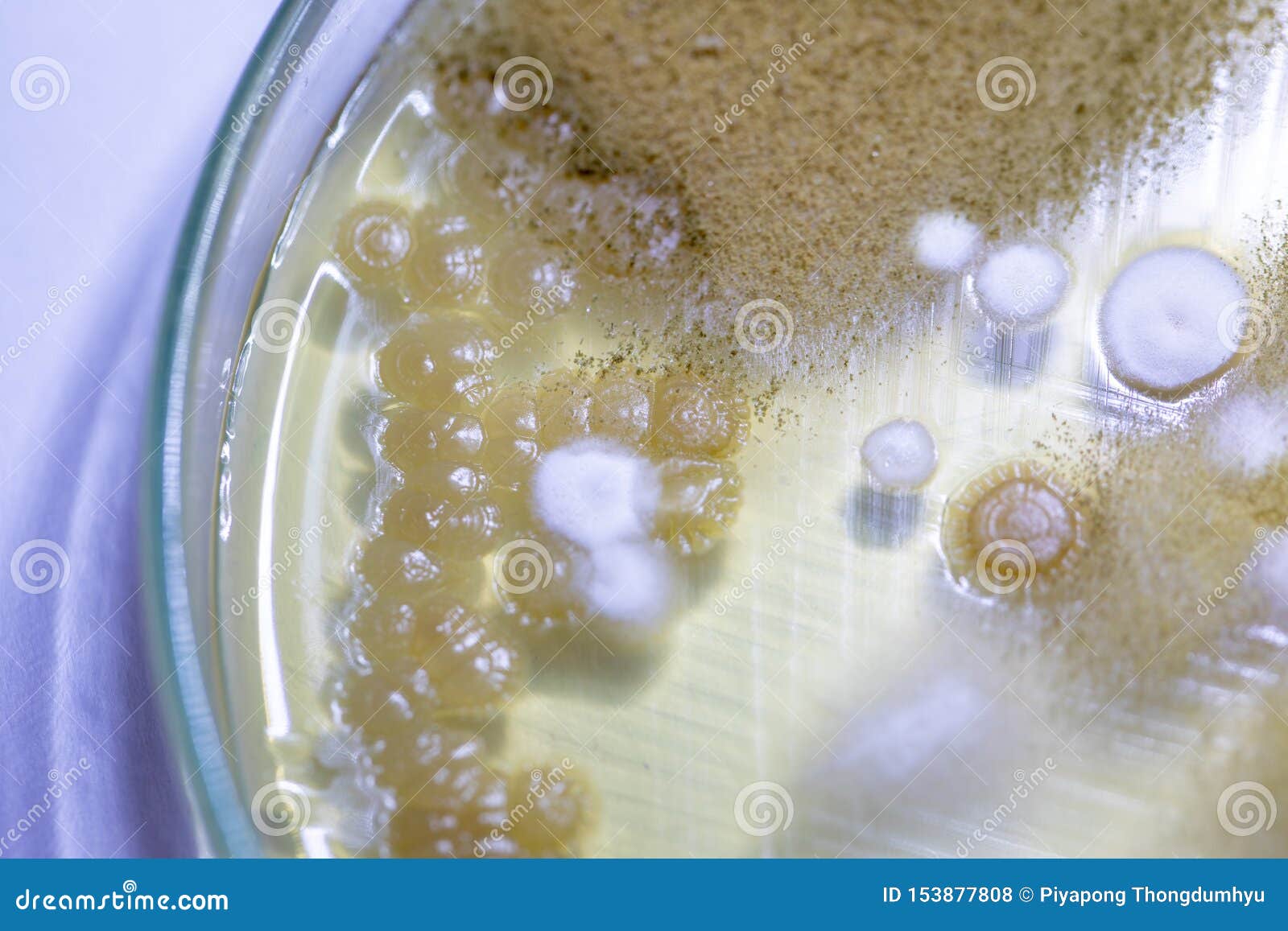 Backgrounds of Characteristics and Different Shaped Colony of Bacteria ...