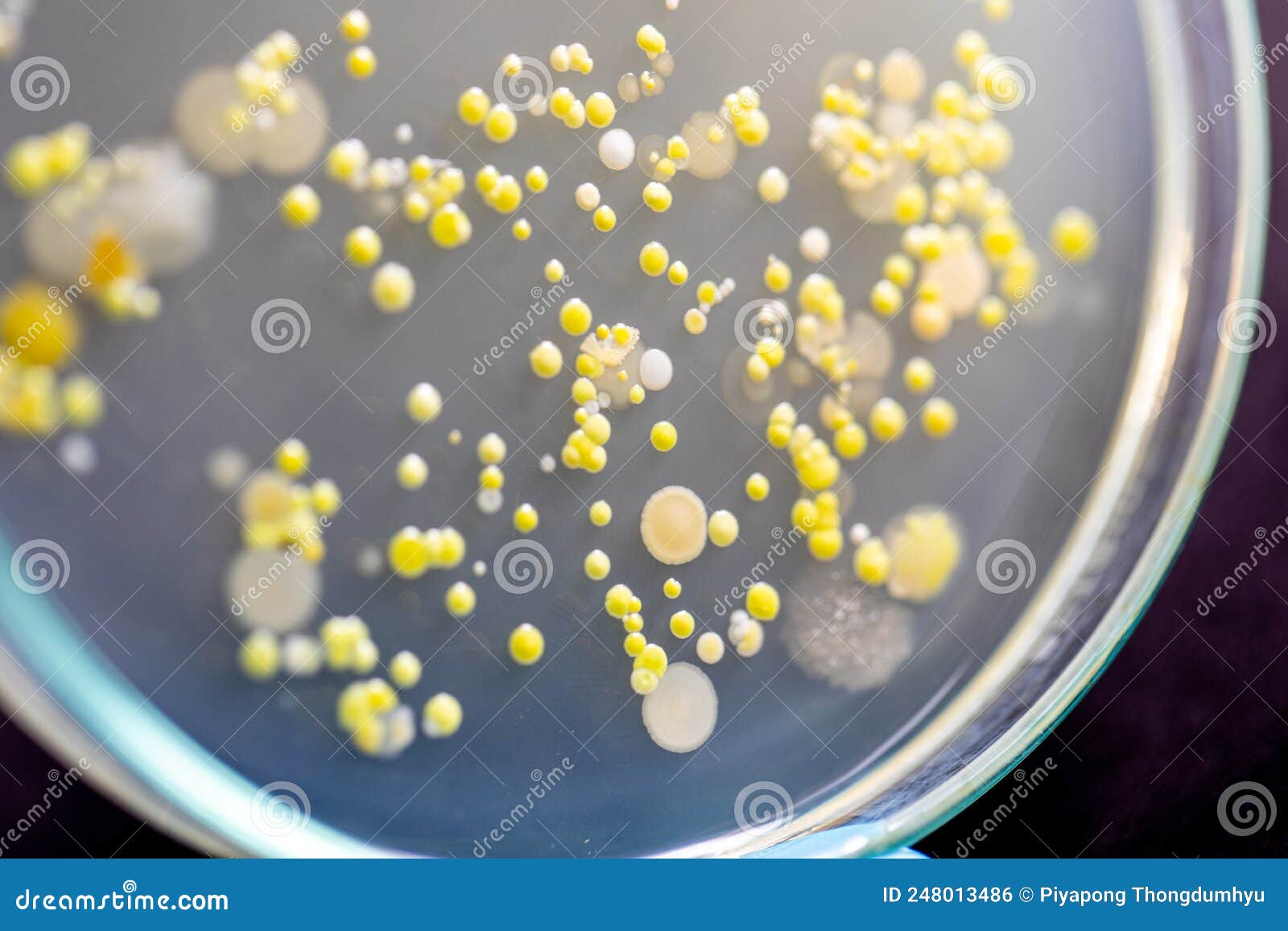 Characteristics and Different Shaped Colony of Bacteria and Mold ...