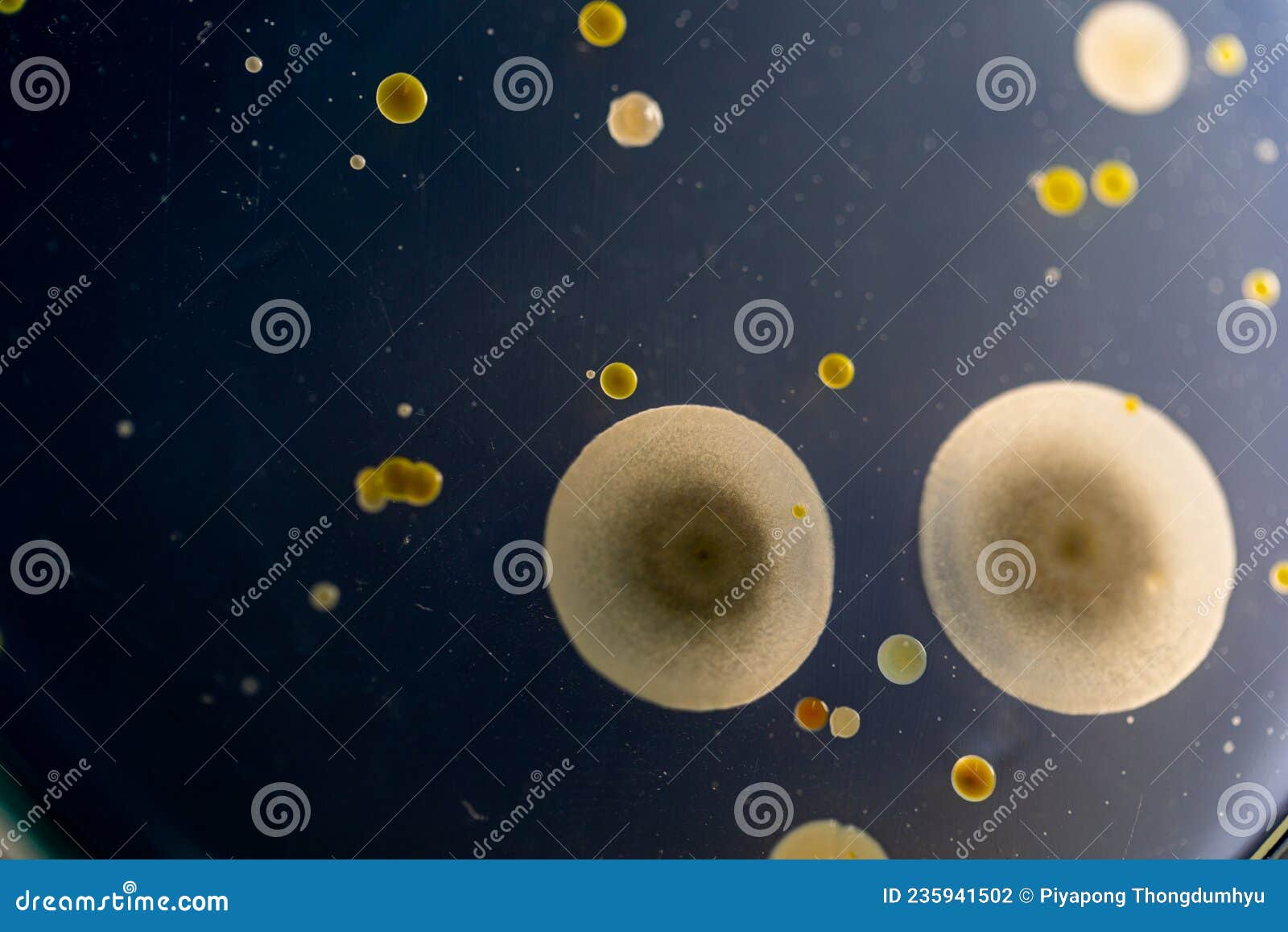 Backgrounds of Characteristics and Different Shaped Colony of Bacteria ...