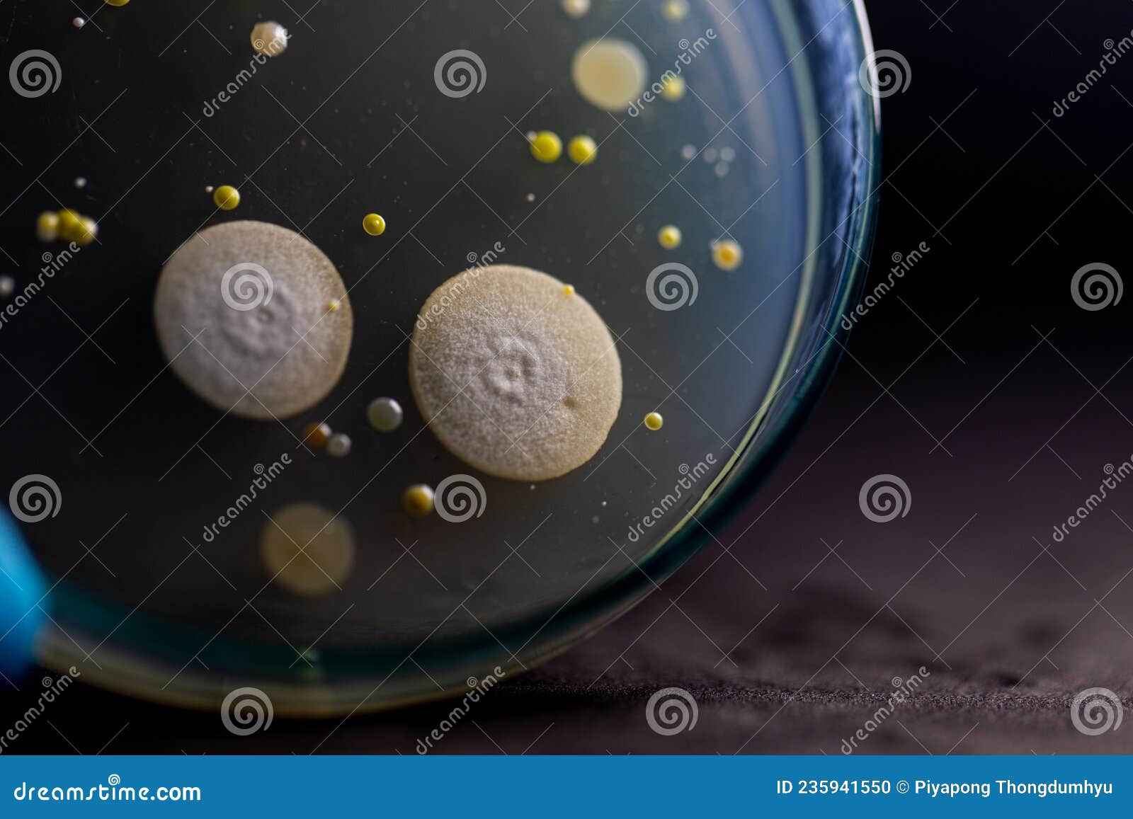 Backgrounds of Characteristics and Different Shaped Colony of Bacteria ...