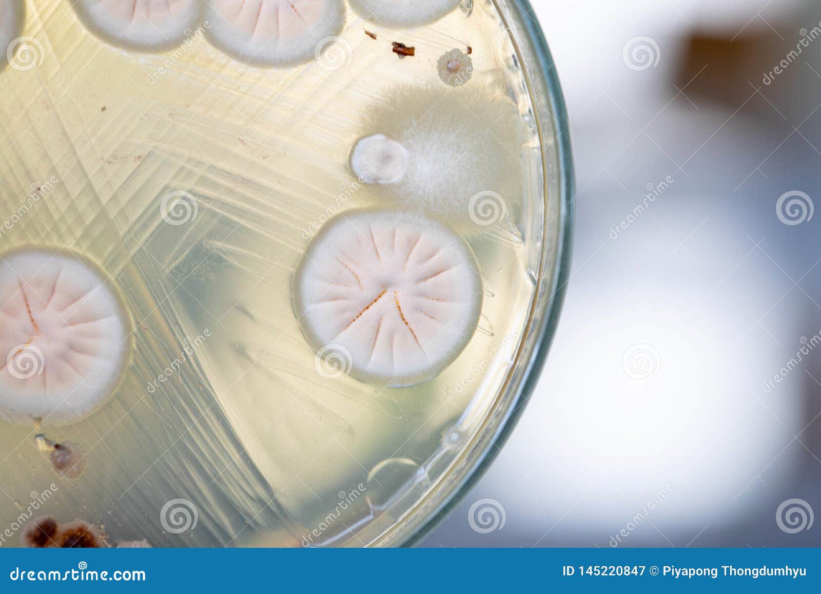 Backgrounds of Characteristics and Different Shaped Colony of Bacteria ...