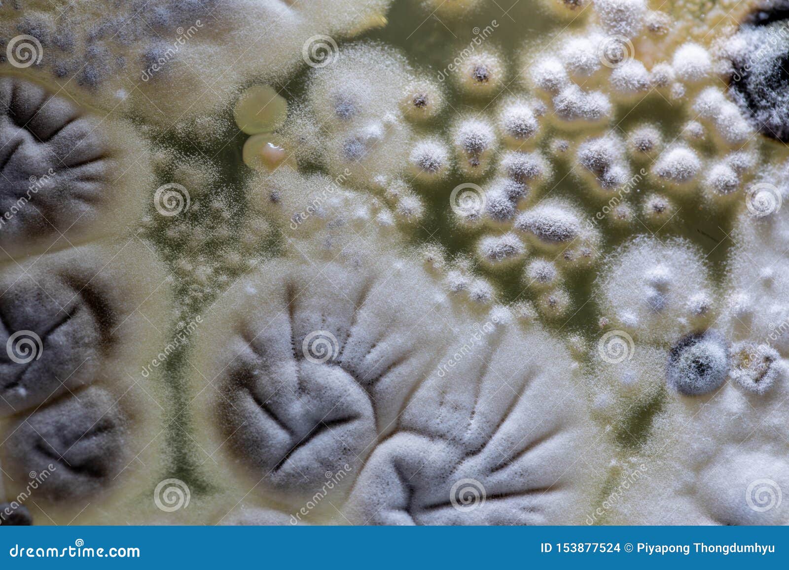 Backgrounds Of Characteristics And Different Shaped Colony Of Bacteria ...