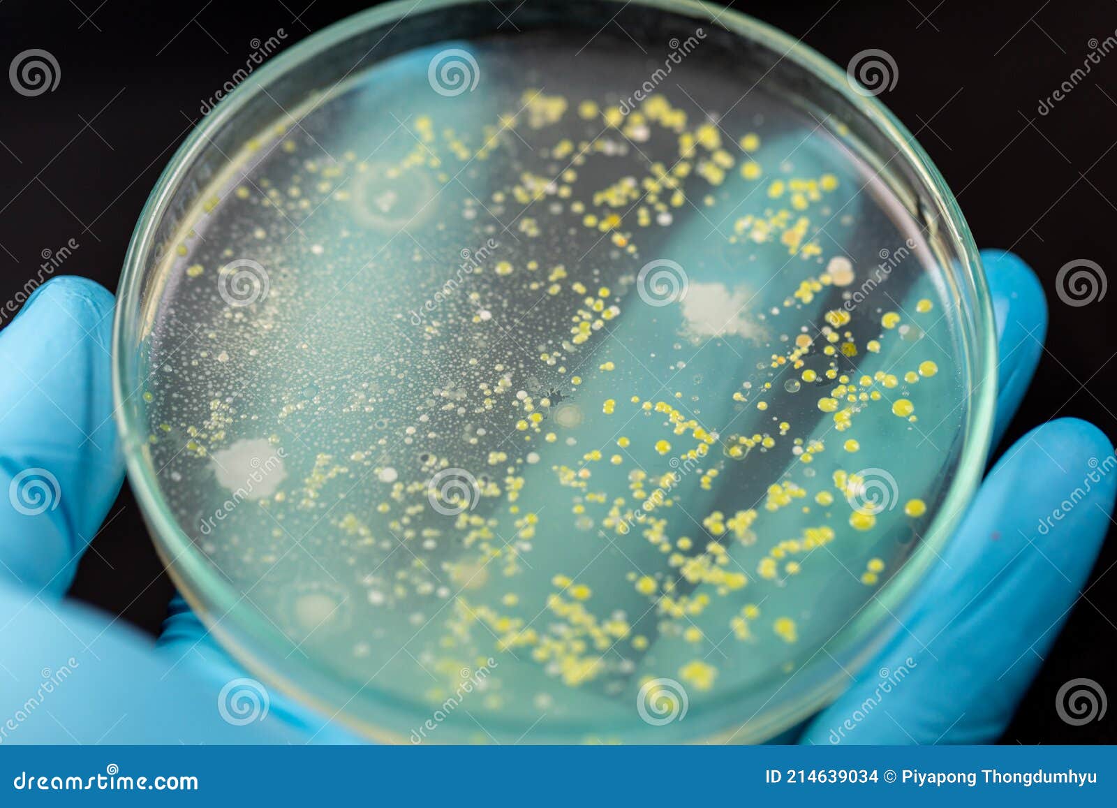 Characteristics and Different Shaped Colony of Bacteria and Mold ...