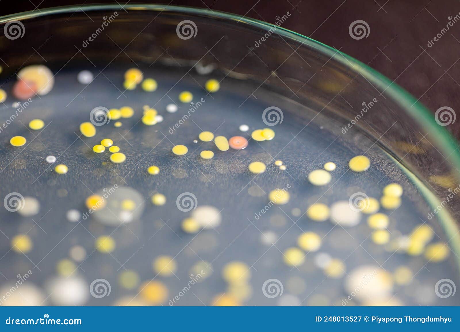 Characteristics and Different Shaped Colony of Bacteria and Mold ...