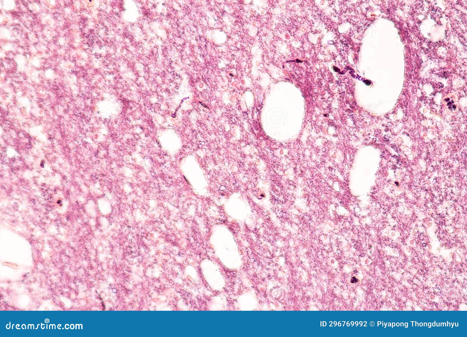 Human Nervous System Under the Microscope in Lab. Stock Photo - Image ...