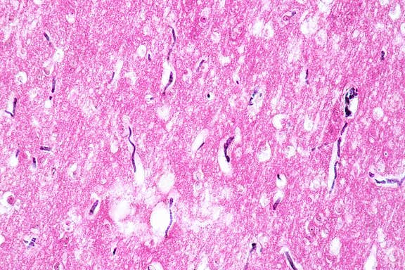 Human Nervous System Under the Microscope in Lab. Stock Image - Image ...