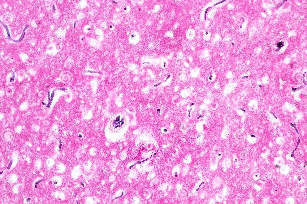 Human Nervous System Under the Microscope in Lab. Stock Photo - Image ...